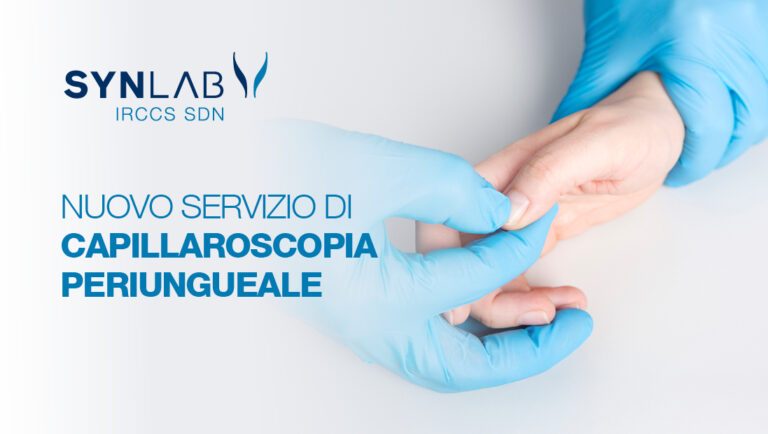 Capillaroscopia Periungueale, ora a Gianturco - SDN Napoli
